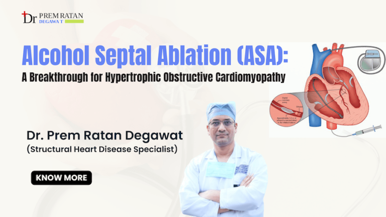 Alcohol Septal Ablation Treatment in Jaipur: Dr. Degawat (Cardiologist)
